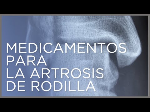Artrotec: Información Comercial y Usos en el Tratamiento de Artrosis