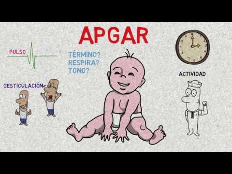 Índice Apgar: Definición y Aplicaciones en el Evaluación Neonatal