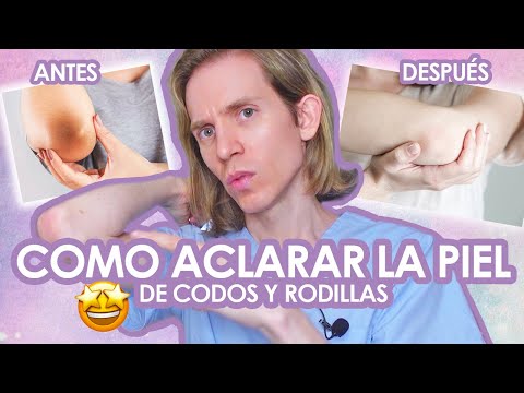 Cómo eliminar las manchas oscuras en rodillas y codos de manera efectiva