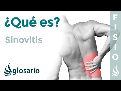 Sinovitis en la Rodilla: Causas, Síntomas y Tratamientos Efectivos