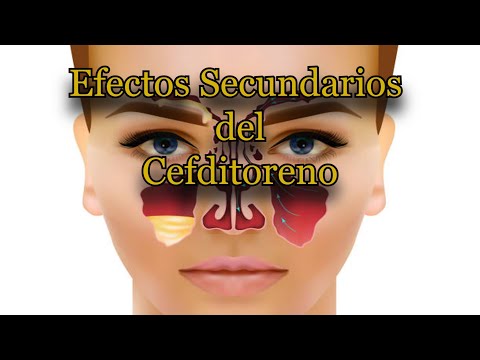 Cefditoreno: Información sobre sus nombres comerciales Meiact, Telo y ...