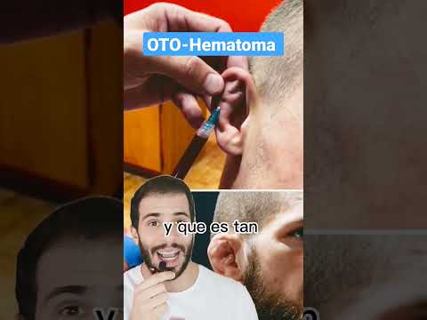 Oreja de Coliflor: Símbolo de Valor y Resiliencia en los Luchadores