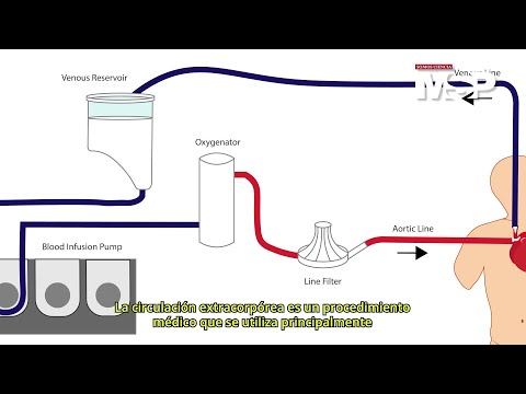 Bypass cardiopulmonar: definición y funcionamiento en cirugía cardíaca