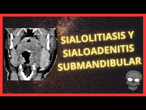 Sialoadenitis: Definición y Explicación en el Diccionario Médico