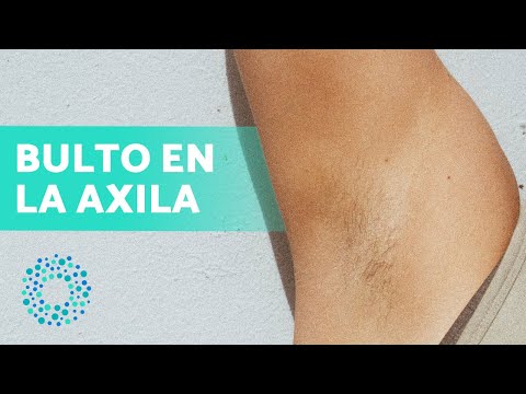 Bulto en la axila: señales de alarma y cuándo consultar al médico