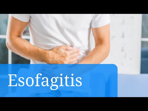 Esofagitis: Causas, Síntomas y Aspectos Clave de esta Condición Médica