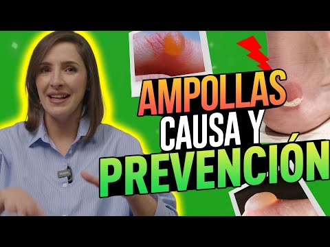 13 Causas Comunes de Ampollas en la Piel y Cómo Prevenirlas