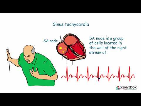 Taquicardia Sinusal: Definición y Explicación en el Diccionario Médico