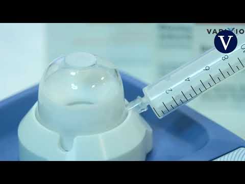 Fleboesclerosis con Microespuma: Efectividad en el Tratamiento de Varices