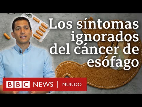 Cáncer de Esófago: Causas, Síntomas y Opciones de Tratamiento