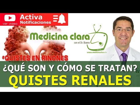 Qué es el quiste simple y su importancia en la salud según el ...