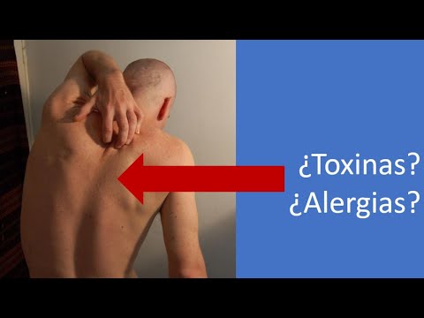 Causas comunes de la picazón en la piel y cómo identificarlas