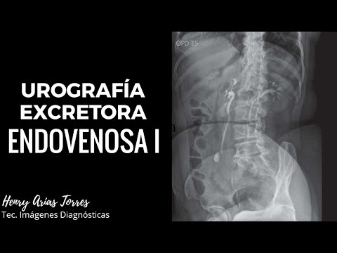 Urografía Intravenosa: Importancia y Procedimiento en Pruebas ...