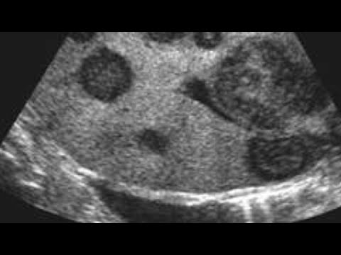 Hipogastrio: Definición y Conceptos Médicos en Clínica Universidad de