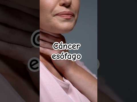 Síntomas de alerta del cáncer de esófago que debes conocer