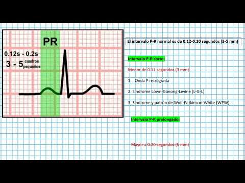 Intervalo PR en el ECG: Definición y Significado Médico
