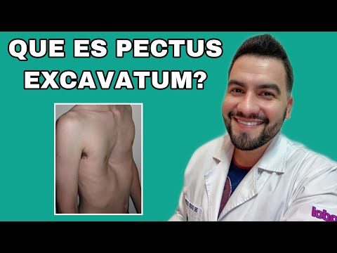 Implicaciones del tórax excavado o pectus excavatum en la salud y ...