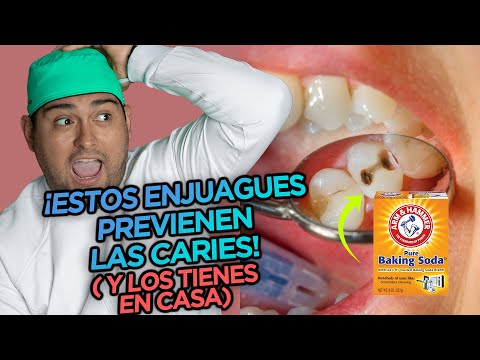 Cinco remedios naturales efectivos para prevenir las caries dentales - SientoSalud