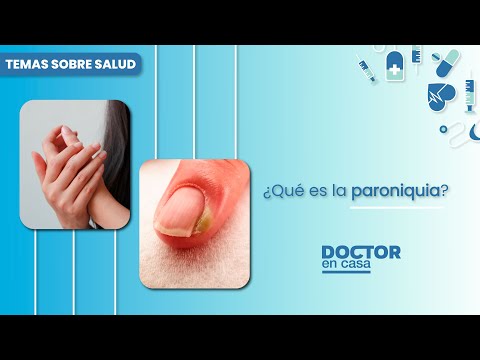 Paroniquia: Definición, síntomas y tratamientos efectivos para su ...