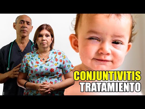 Conjuntivitis en niños: recomendaciones para el cuidado y tratamiento ...