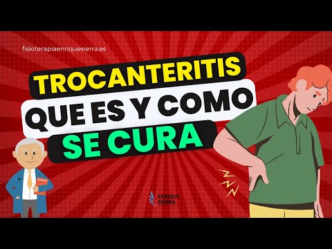 Trocanteritis en mujeres: causas, síntomas y tratamientos efectivos