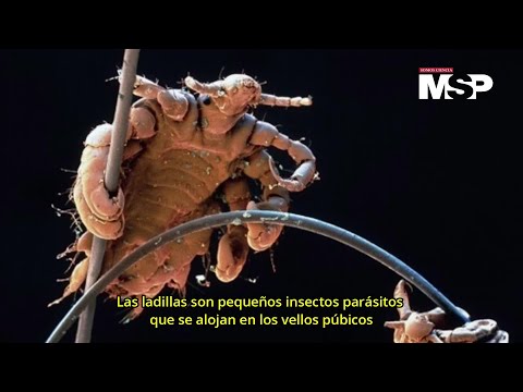 Tratamiento y Prevención Efectiva de la Infección por Ladillas