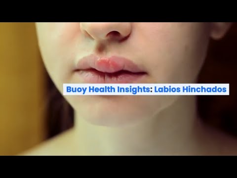 12 Causas Comunes de los Labios Hinchados y Sus Soluciones