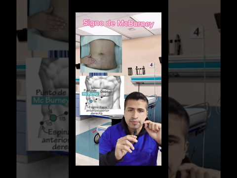 Signo de Mc Burney: Definición y Relevancia en el Diagnóstico de ...