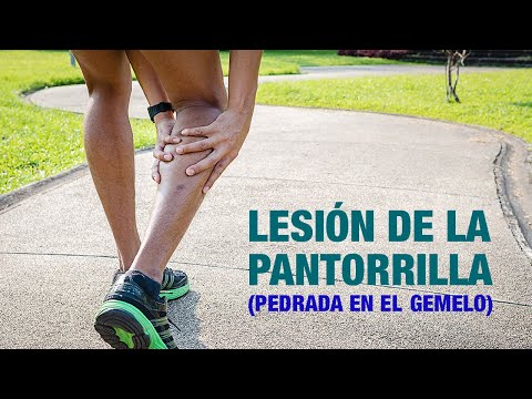 Rotura muscular de gemelo interno: causas, síntomas y tratamiento efectivo