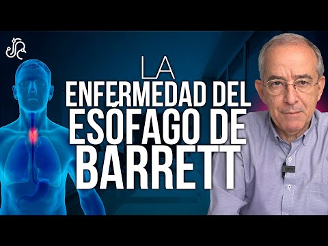 Síntomas Comunes de las Principales Enfermedades del Esófago - SientoSalud