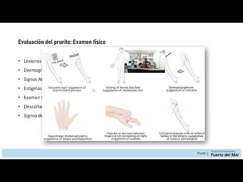 Prurito: Definición y Causas en el Diccionario Médico