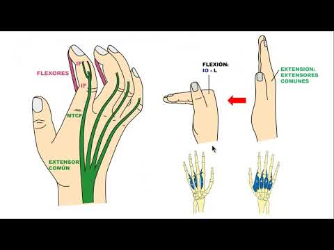 Mano en garra: Definición y Significado en el Diccionario Médico