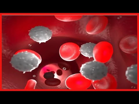 Monocitos Altos en Sangre: Síntomas, Causas y Opciones de Tratamiento