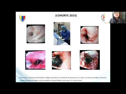 Mitomicina C: Información esencial sobre su uso y aplicaciones médicas