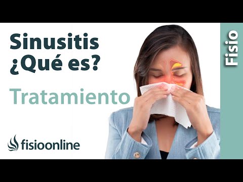 Sinusitis: Causas, Síntomas, Prevención y Opciones de Tratamiento Efectivas
