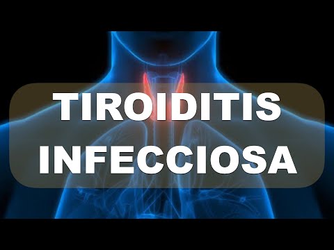 Tiroiditis Aguda: Definición y Conceptos Clave en el Diccionario Médico