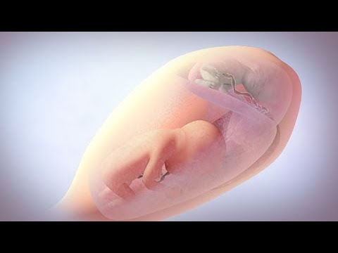 Síndrome del gemelo evanescente: Causas y consecuencias en la salud materna e infantil