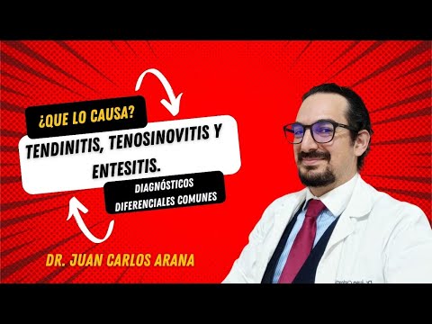 Entendiendo la entesitis: síntomas, causas y opciones de tratamiento