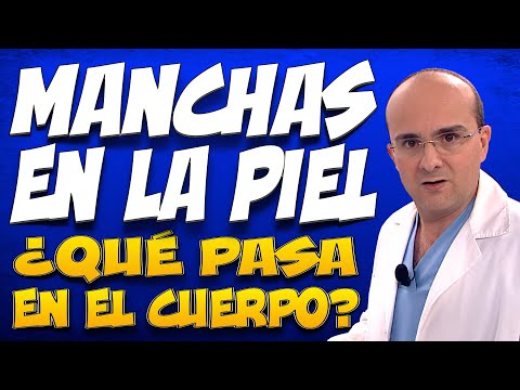 Causas y Tratamientos para las Manchas Oscuras en la Piel