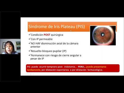 Síndrome Iris Plateau: Definición y Conceptos Clave en el Diccionario ...