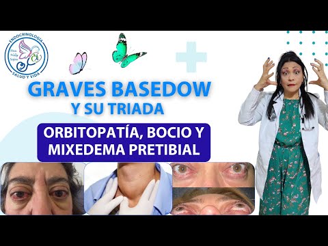 Mixedema: Definición y Tratamiento en el Diccionario Médico de Clínicas