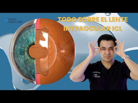 Extracción extracapsular del cristalino: Procedimiento, indicaciones y ...