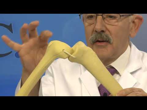 Sinovitis Simple: Definición y Tratamiento en Clínica U. Navarra