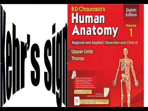 Signo de Kehr: Definición y Relevancia en el Diagnóstico Médico