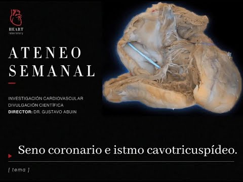 Seno Coronario Definición y Función en Cardiología Clínica U. Navarra